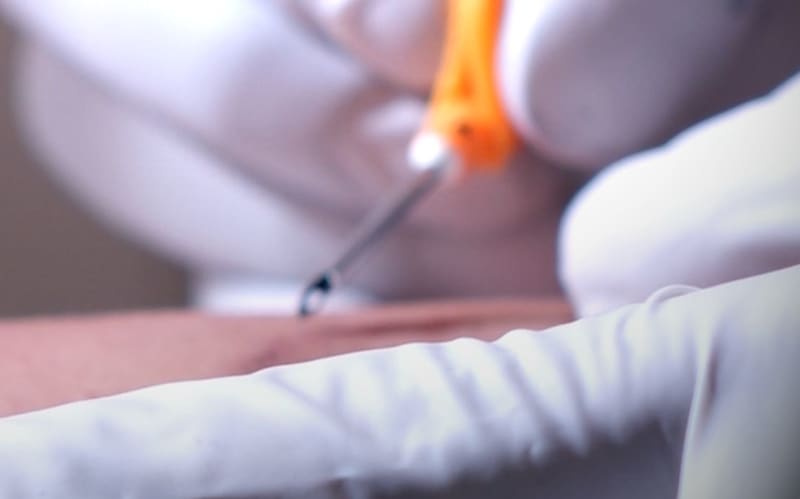 Tonga Dialysis Foundation says Govt delaying treatment | RNZ