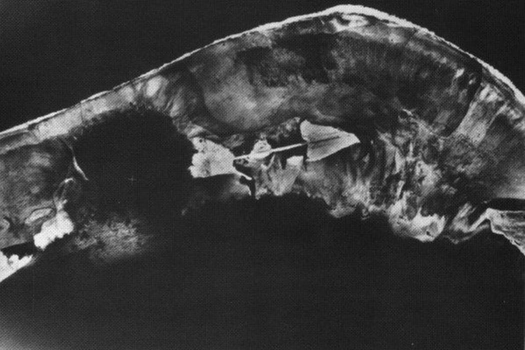 US nuclear testing legacy lingers in the Marshall Islands | RNZ