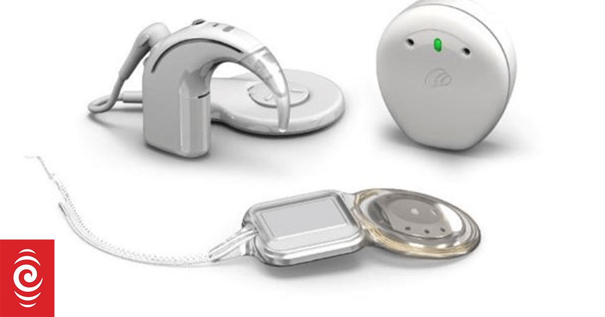 What will new 'smart' implants mean for hearing loss patients | RNZ
