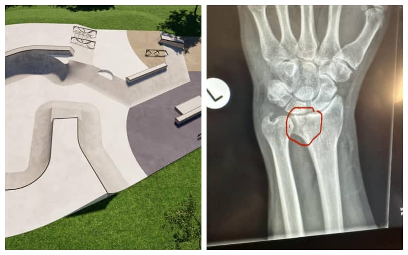 New Plymouth mayor takes tumble, breaks wrist at skatepark opening | RNZ