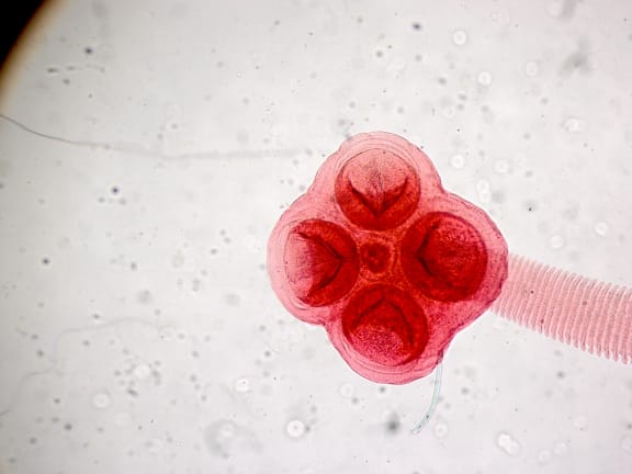 For the love of .....parastic worms! | RNZ