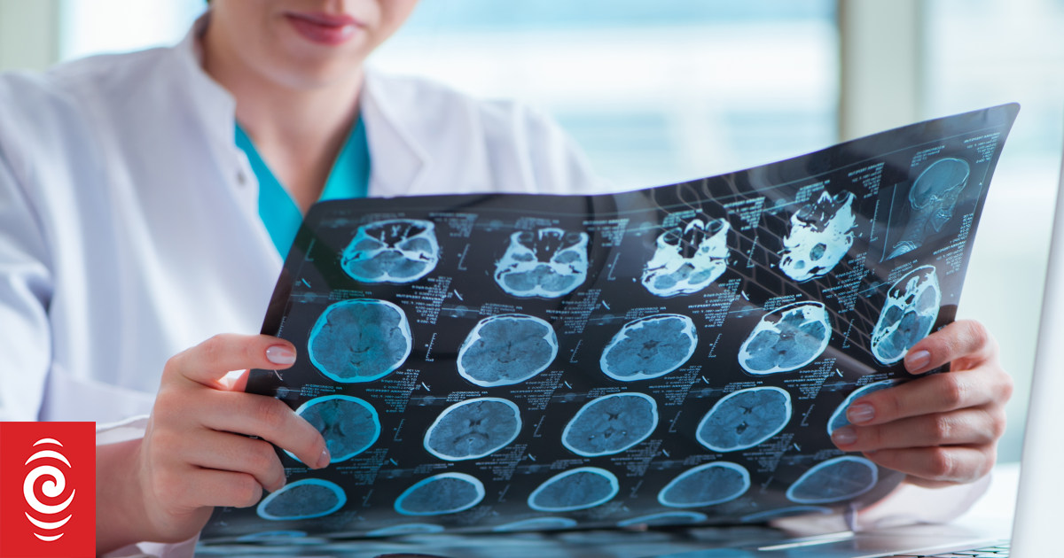 Cost of medical imaging scans increases | RNZ News