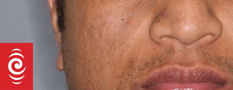 Rapper Scribe sentenced to six months' supervision over charges | RNZ News