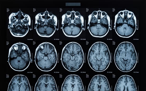 Got pain? How new approaches could offer relief | RNZ