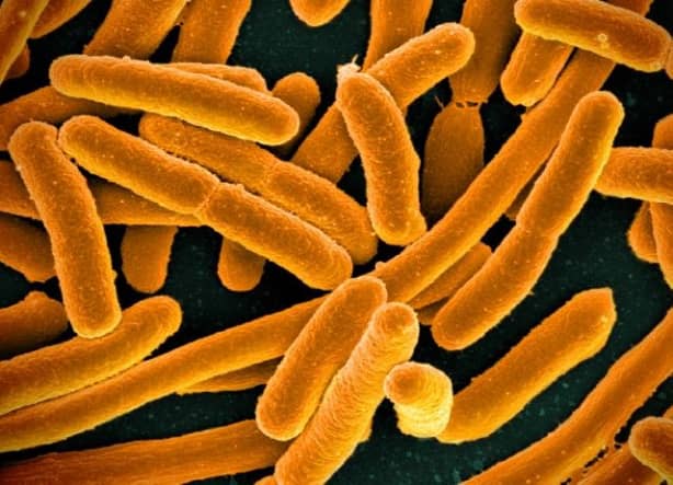 More tests after E coli detected in reservoir | RNZ