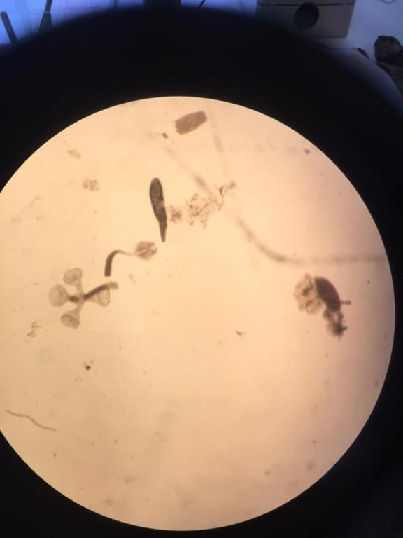 Parasites of New Zealands native rough skate | A Gallery from ...