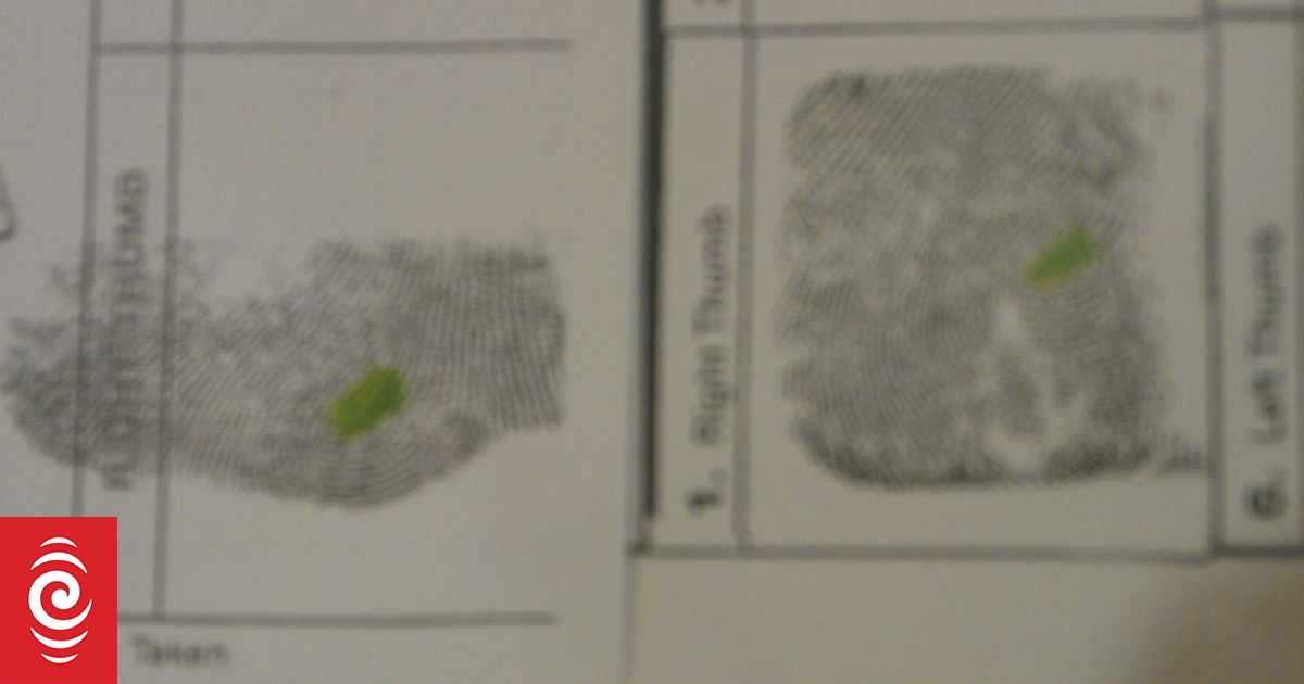 Karam insists Robin Bain's thumb marks are not injuries | RNZ News