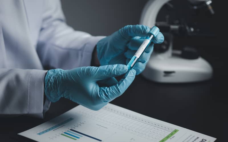 Gisborne lab tests facing delays as samples sent across country | RNZ