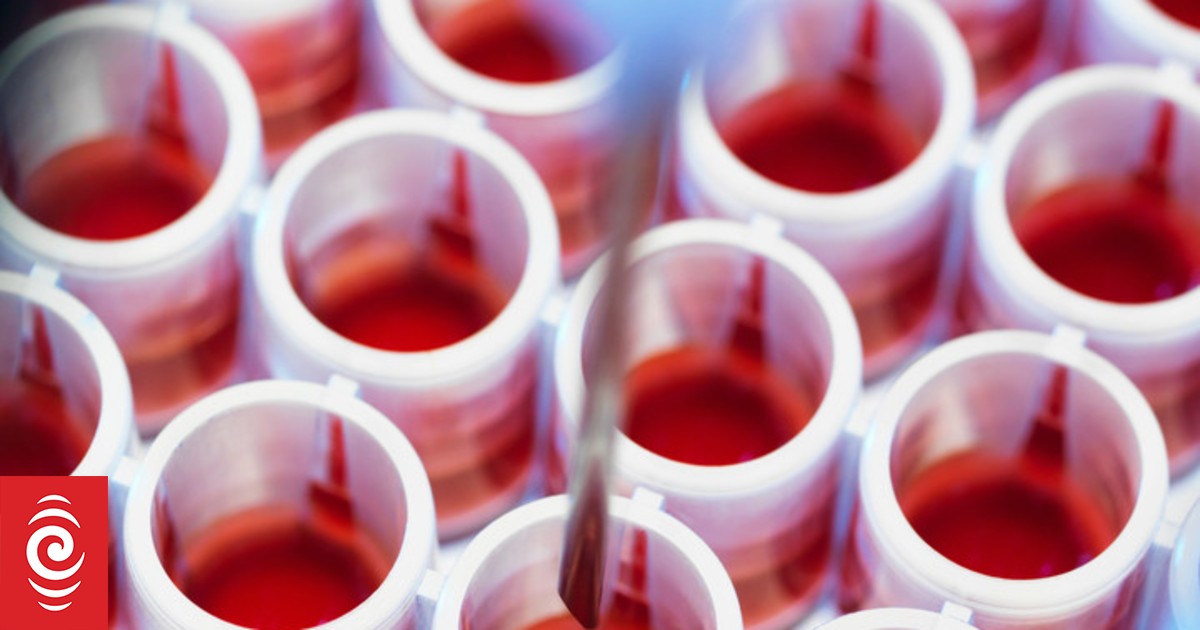 Blood tests can reveal higher toxicity foam chemical - ministry | RNZ News