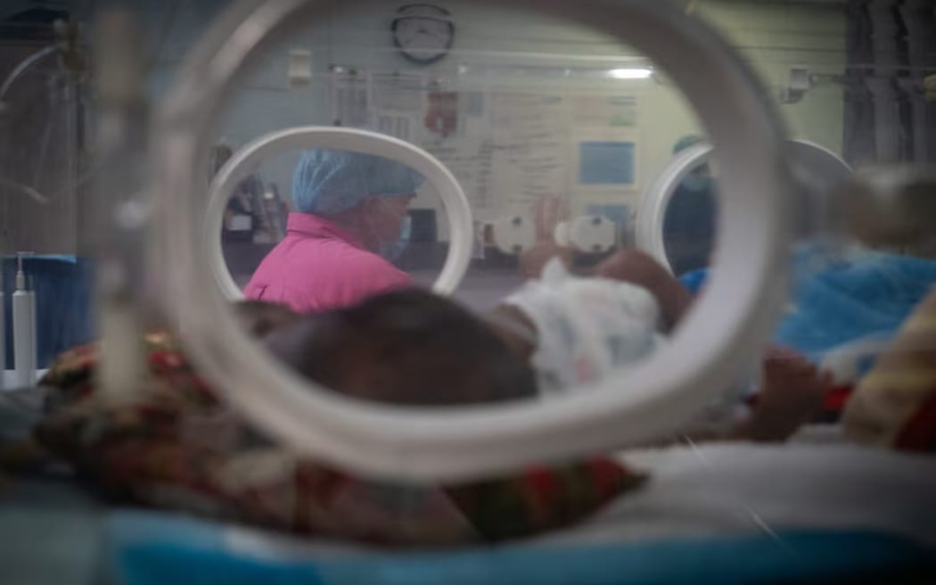 The race to save a conjoined twin | RNZ News