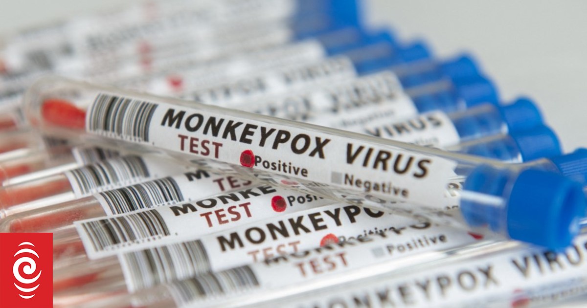 Wastewater testing for monkeypox being trialled in New Zealand's main ...