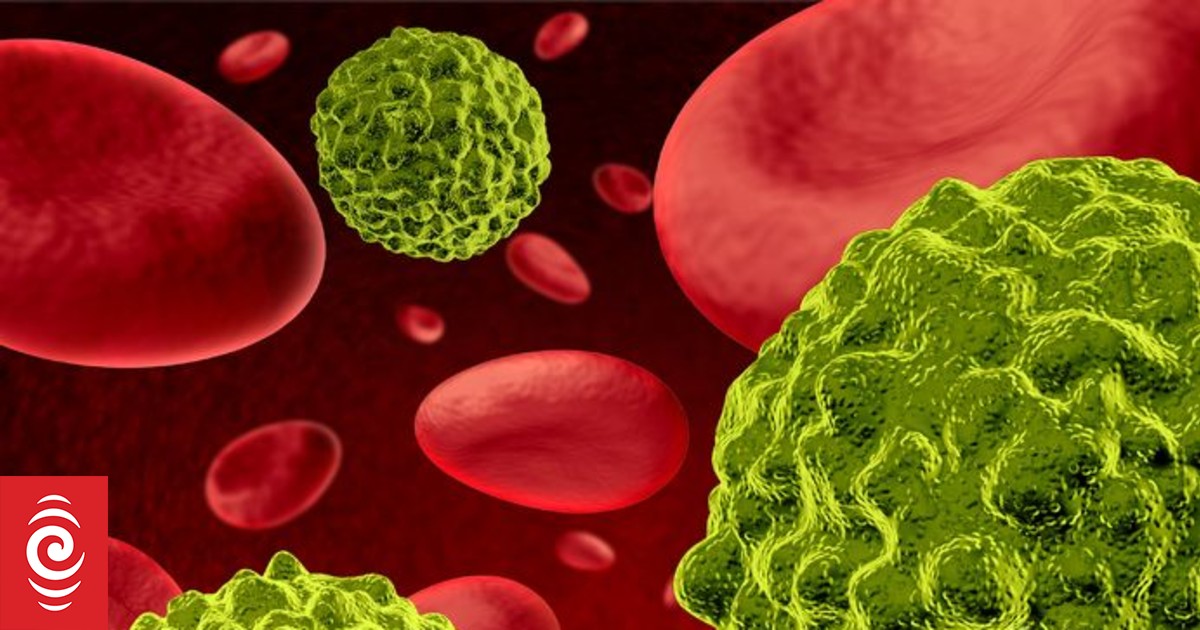 Patients dying waiting for treatment - cancer specialist | RNZ News