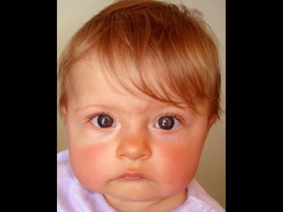 Miracle Man Dr Swee Tan | A Gallery from Asian Report | RNZ National