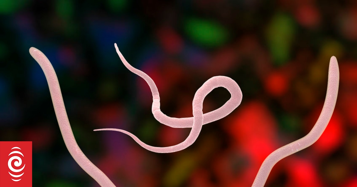 Unravelling the worms within... | RNZ