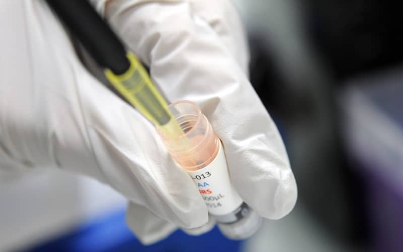Lab workers seek upgrade of hospital labs | RNZ