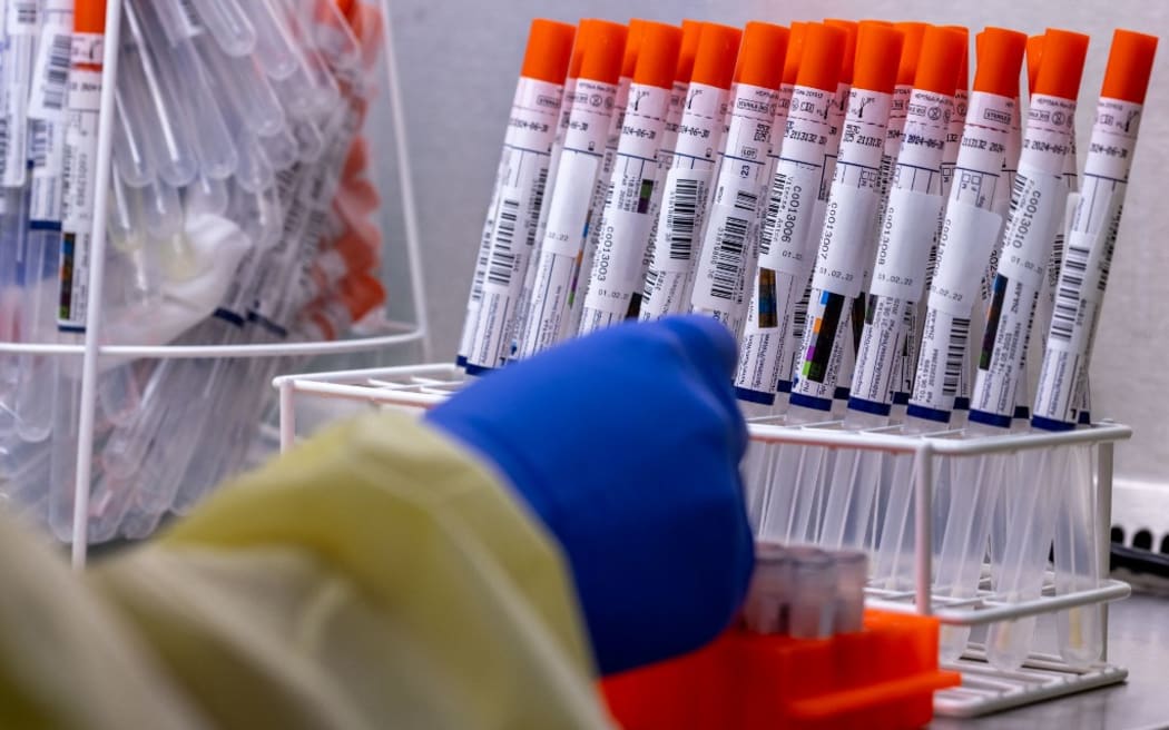 Health ministry overestimated lab's PCR testing capacity, review finds ...
