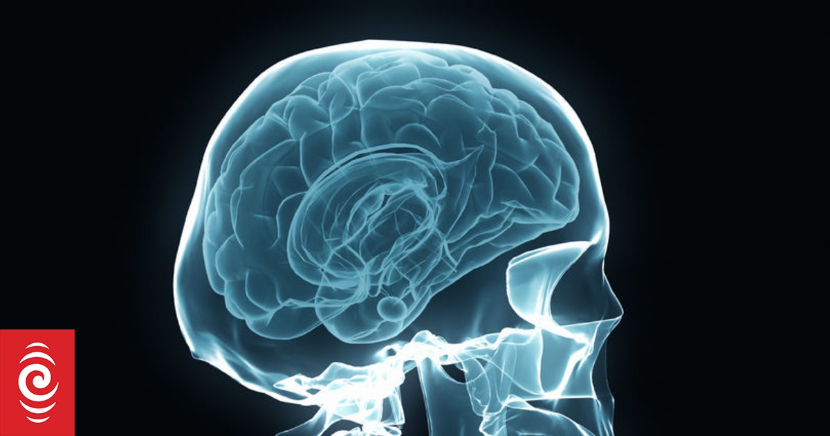 Frontal Fatigue: how technology is overstressing our brain | RNZ