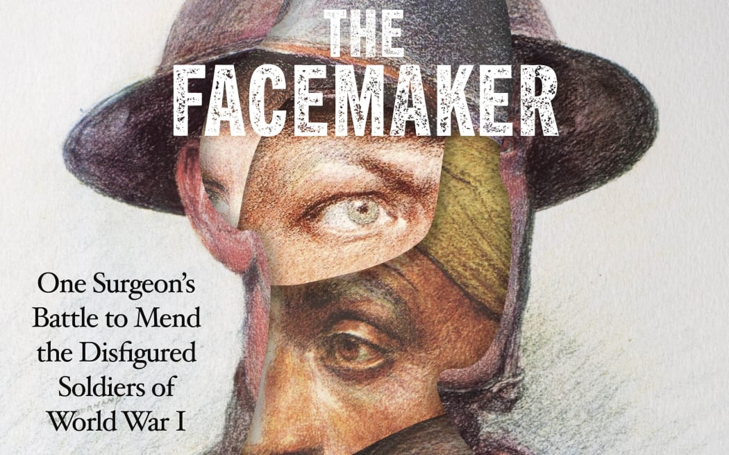 Book review - The Facemaker by Lindsey Fitzharris | RNZ