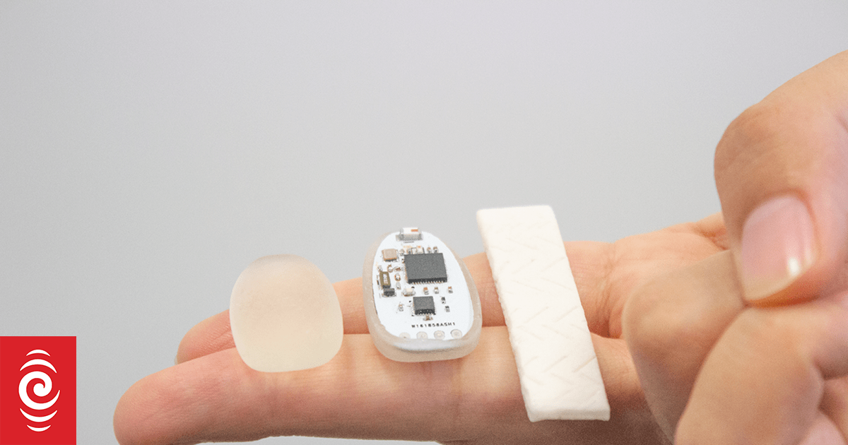 ChewIt - novel way to answer your mobile | RNZ