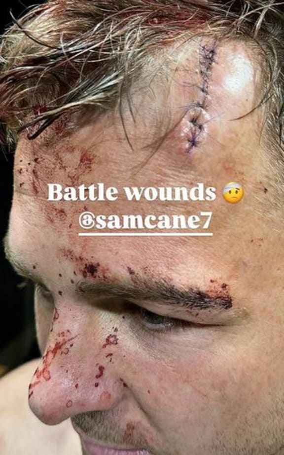 Rugby: Cane in doubt for France test, Barrett and Taylor expected back ...