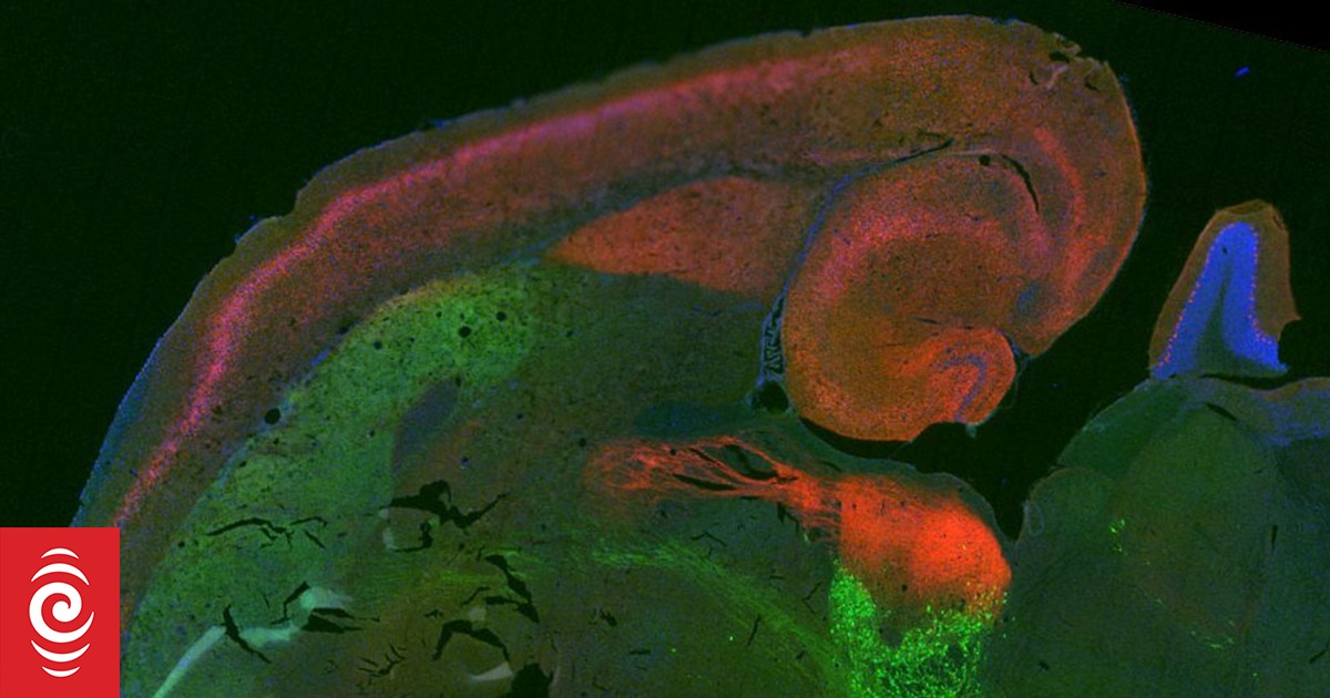 Using light and electricity to study individual brain cells | RNZ News