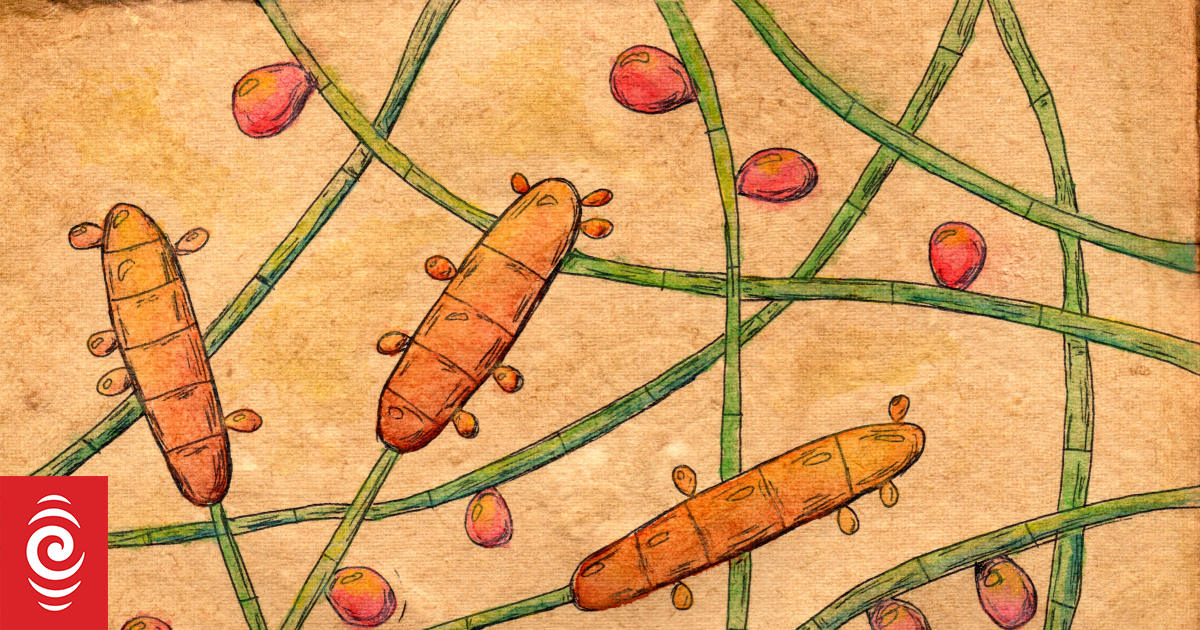 New strain of drug-resistant fungus that causes ringworm found in New ...