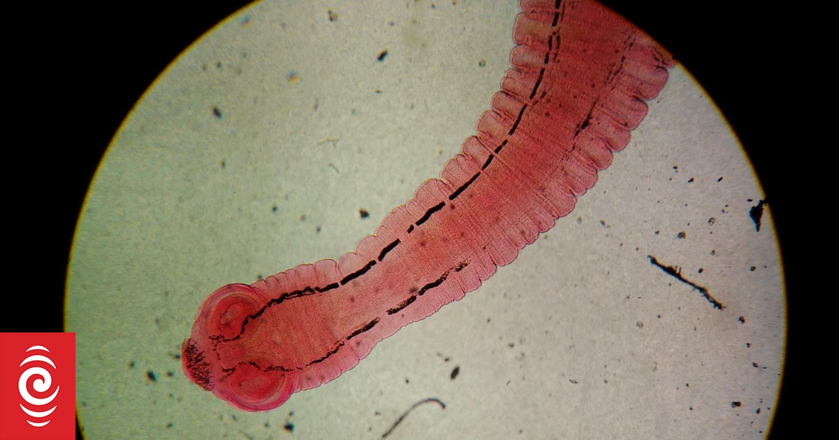 Gut worms may be healthy - research | RNZ News