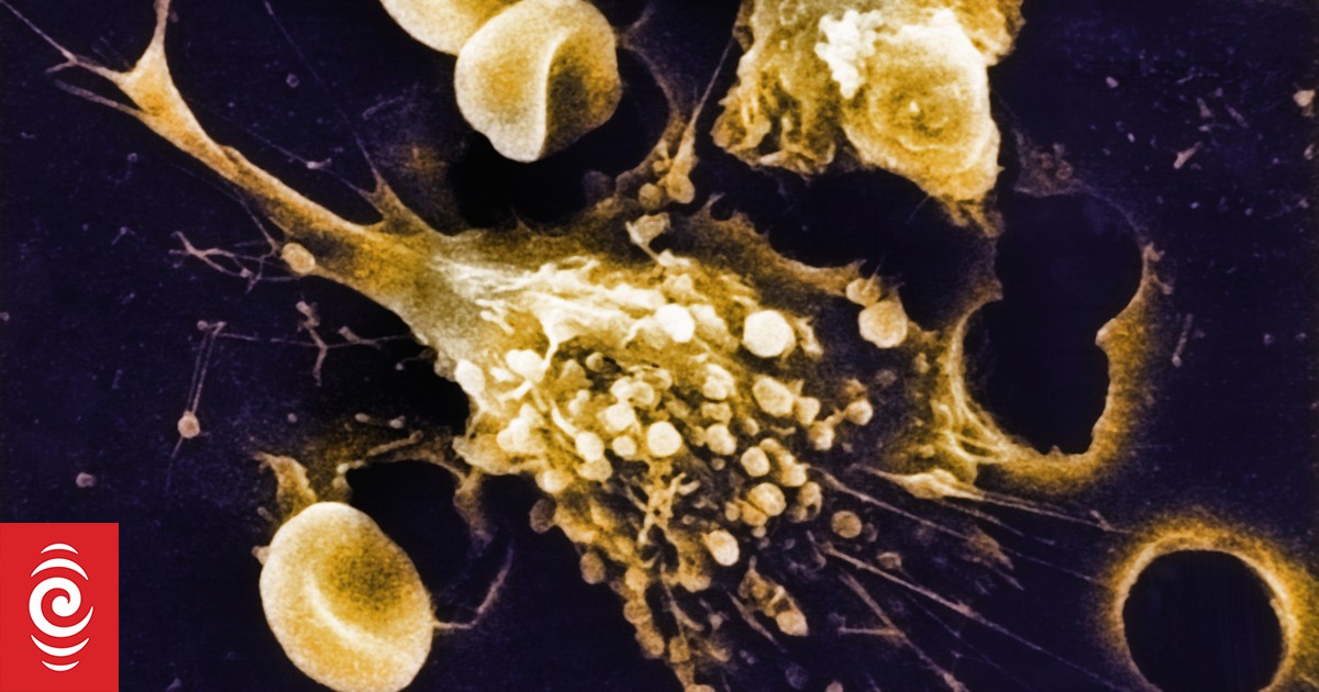 Theories put forward for Micronesia's high cervical cancer rates | RNZ News