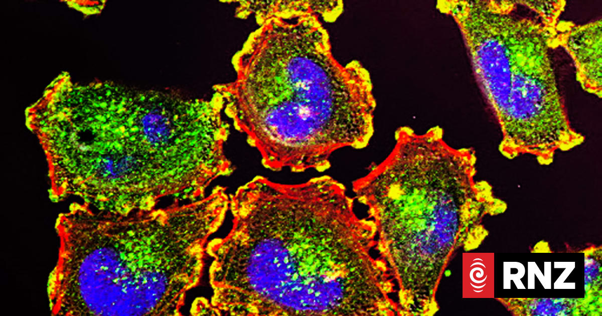 Melanoma drug decision 'disappointing' | RNZ