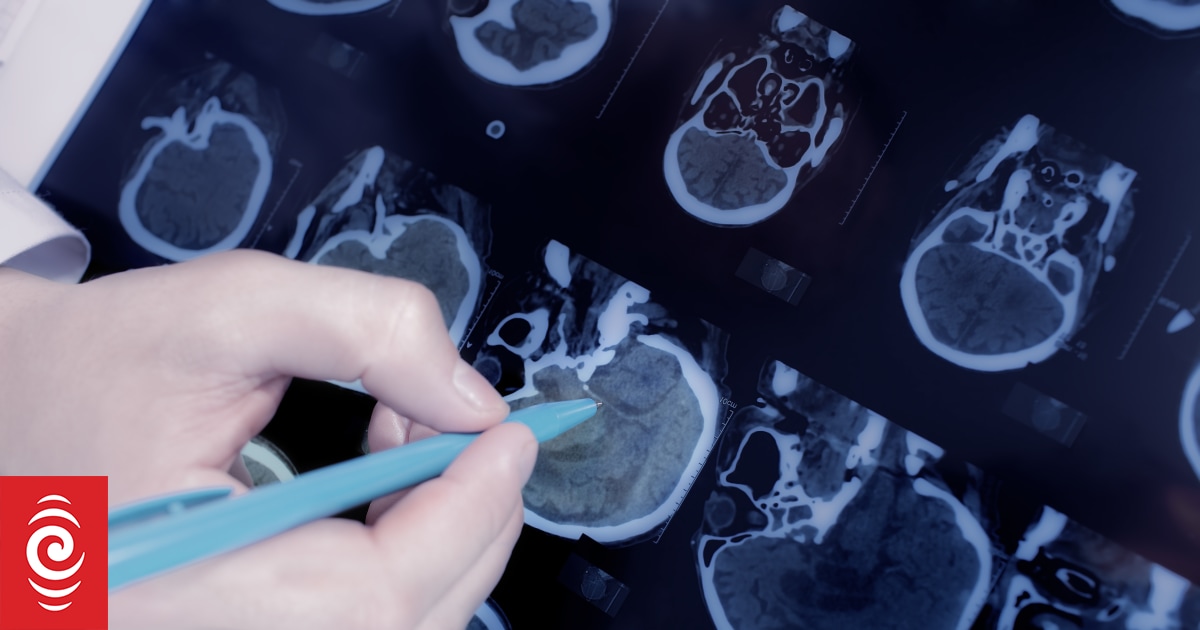 Dr Matthew Phillips: could fasting and keto heal brains? | RNZ