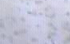 UN tells Bougainvilleans there is no recognition for Musingku | RNZ News