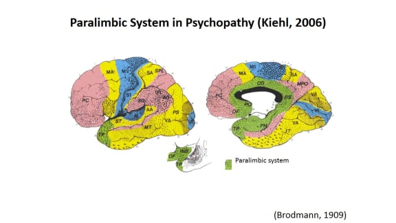 Inside the brains of psychopaths | RNZ