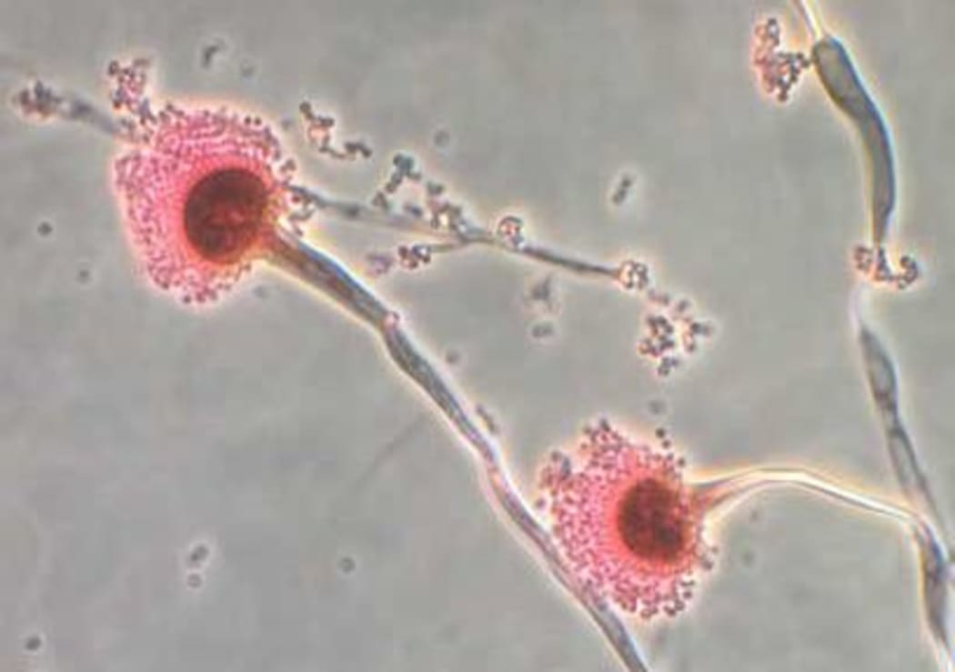 aspergillus ustus complex