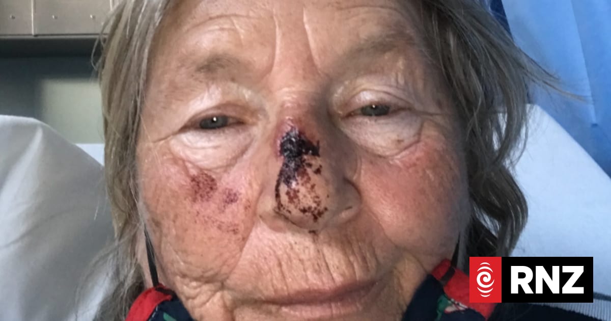 Dream fishing charter trip ends in nightmare after two injured crossing ...