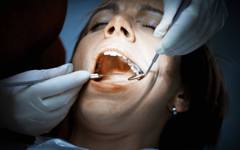 Dental Association urges sugary drinks levy as one in three suffer ...