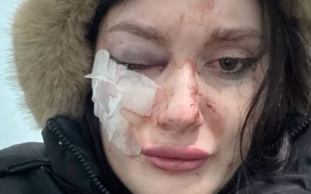 Mariana's husband beat her but police were no help, so she wrote to ...