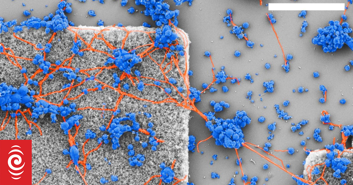 Prof Richard Taylor: bio-inspired technology improving the eye | RNZ