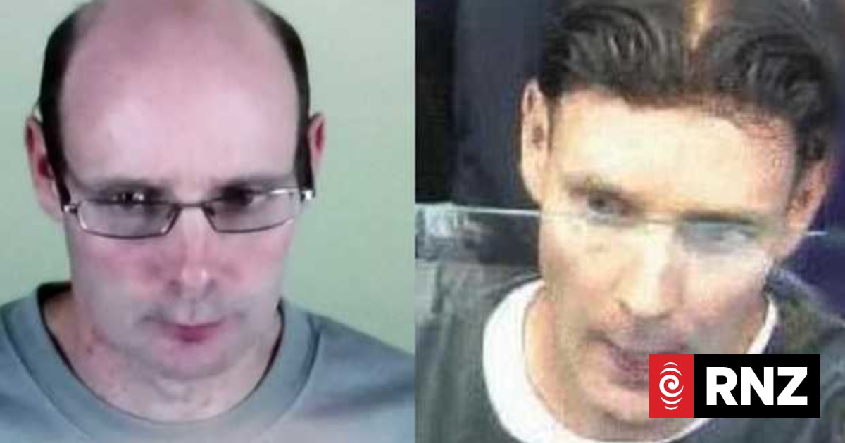 A bald act of expression | RNZ
