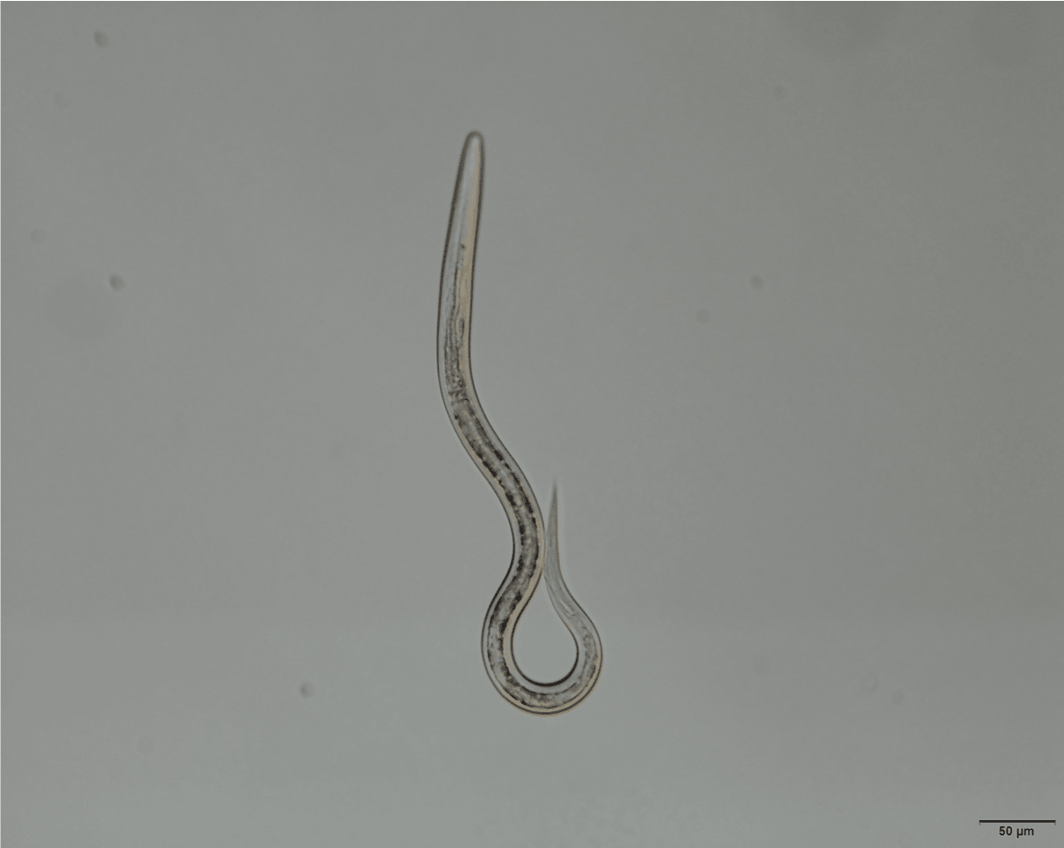 Human hookworms: potential to help inflammatory diseases | RNZ