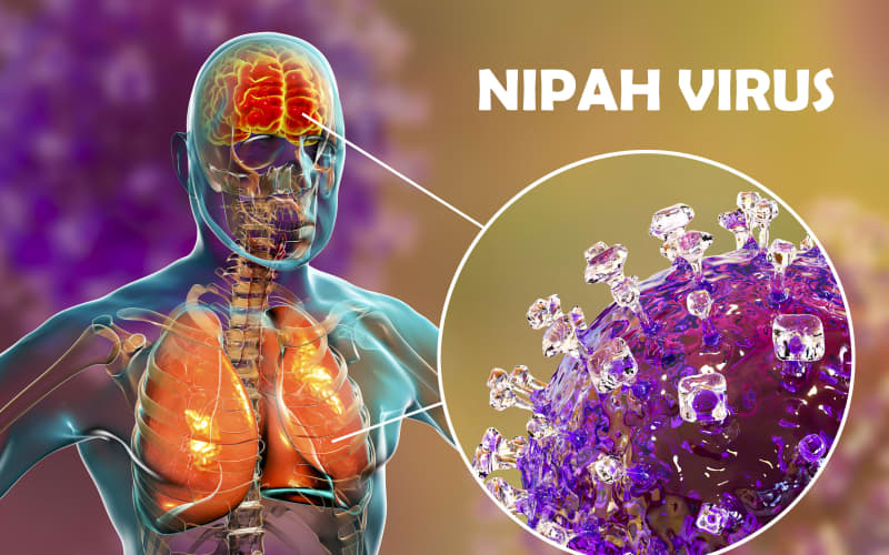 Nipah virus: What to know after cases emerge in India | RNZ