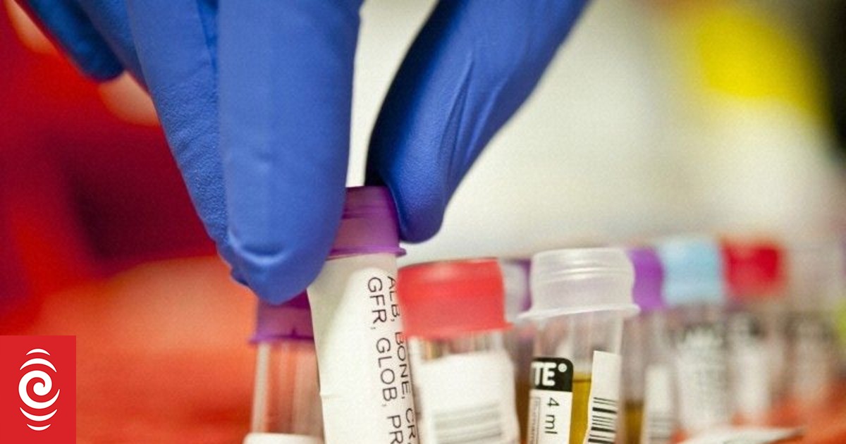 Could a blood test reveal you've had a stroke? | RNZ
