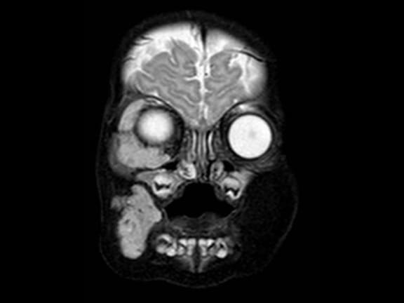 Miracle Man Dr Swee Tan | A Gallery from Asian Report | RNZ National