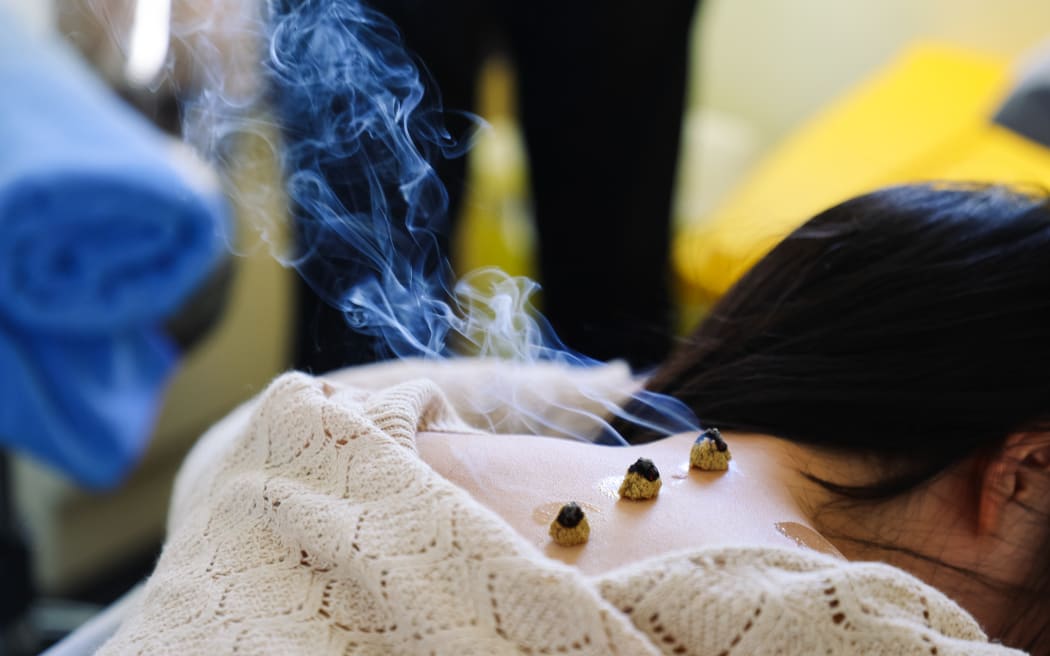 Traditional Chinese medicine finding a place in New Zealand | RNZ News