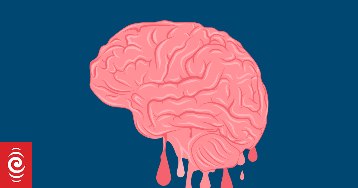 What is Brain Rot, the Oxford Dictionary's Word of the Year? | RNZ News