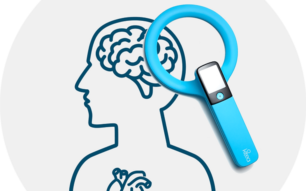 Helping the brain drain | RNZ