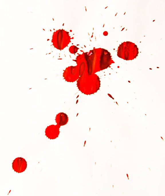 The physics of blood spatter | RNZ
